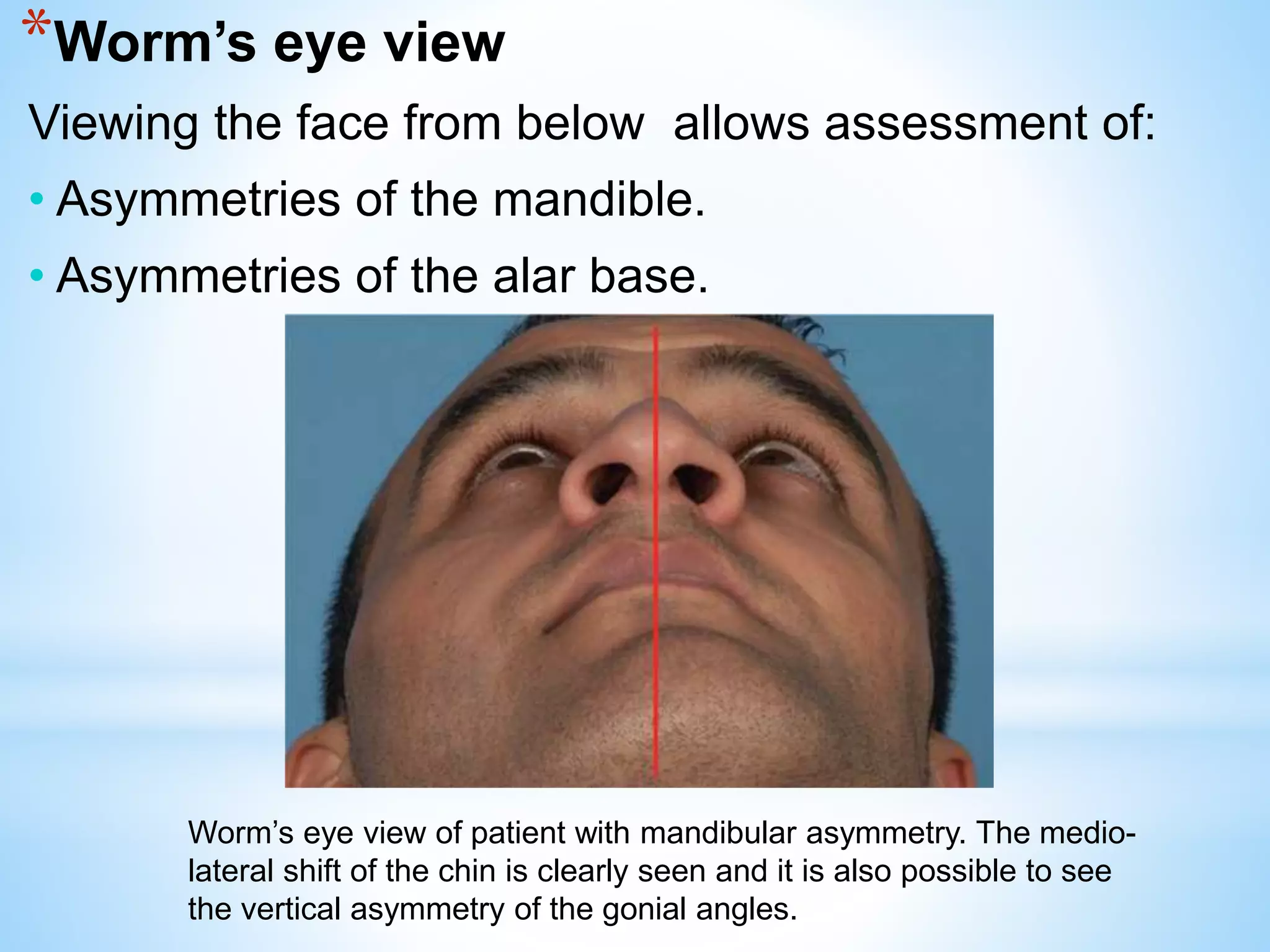 Orthognathic treatment for skeletal class iii malocclusion nehal fouad ...