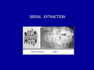 Ortho Introduction Ortho IntroductionOrtho Introduction | PPT