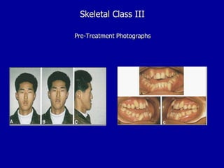 Ortho Introduction Ortho IntroductionOrtho Introduction | PPT