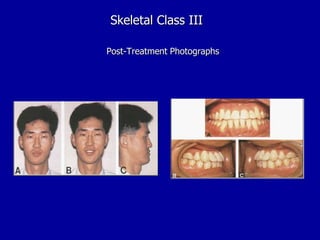 Ortho Introduction Ortho IntroductionOrtho Introduction | PPT