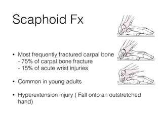 Orthokorat scaphoid fx c perilunate dislocation | PPT