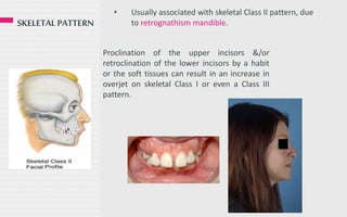 Definition, etiology and treatment of class II malocclusion | PPTX
