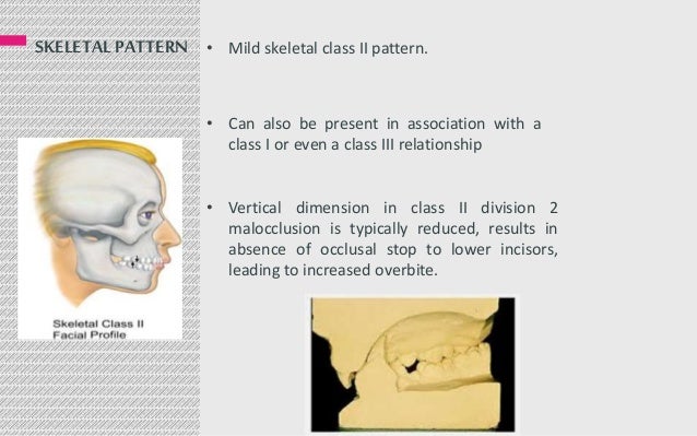 Definition, etiology and treatment of class II malocclusion