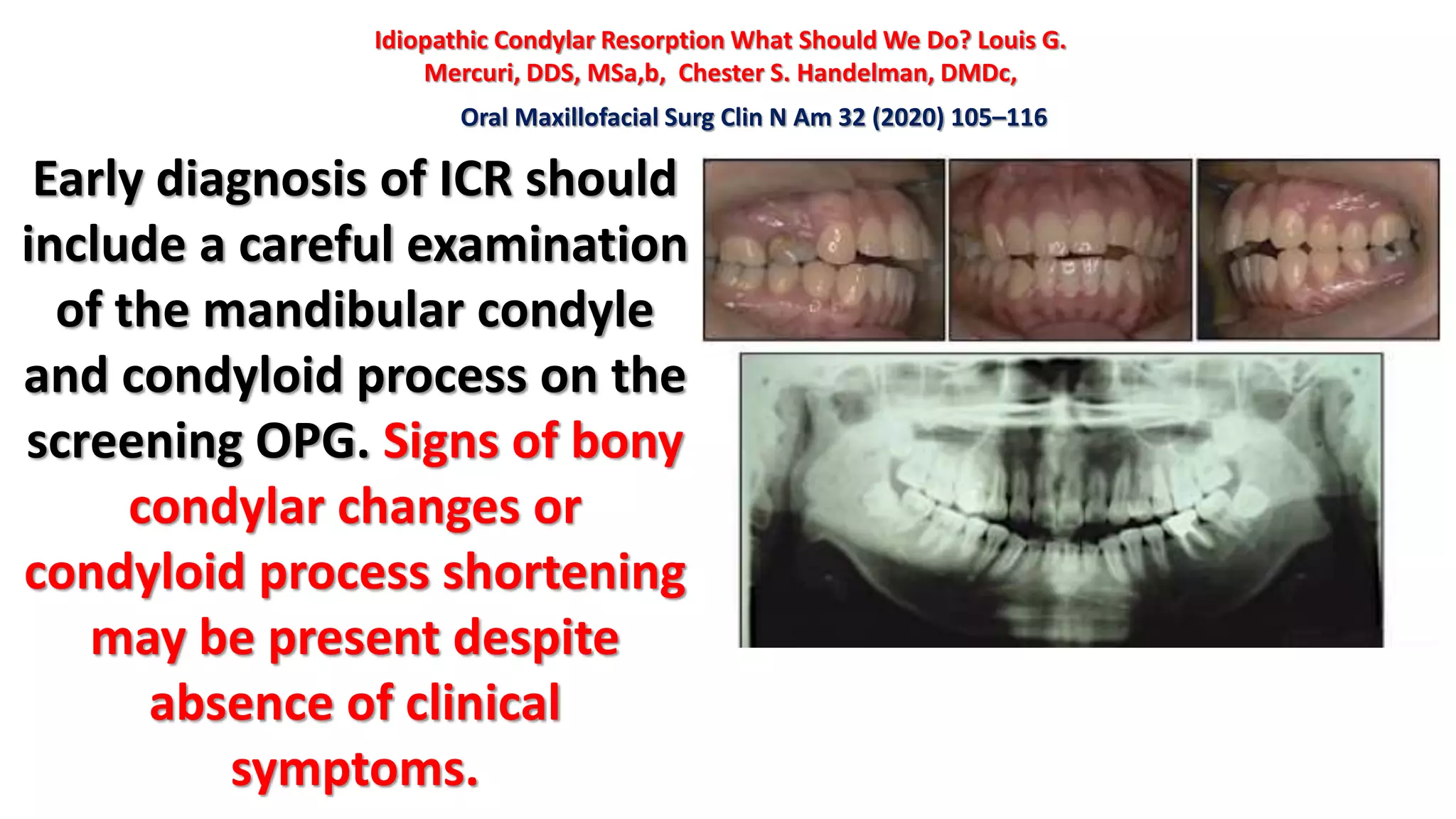 Ortho manage of idiopathic condylar resorption part 1 | PPTX