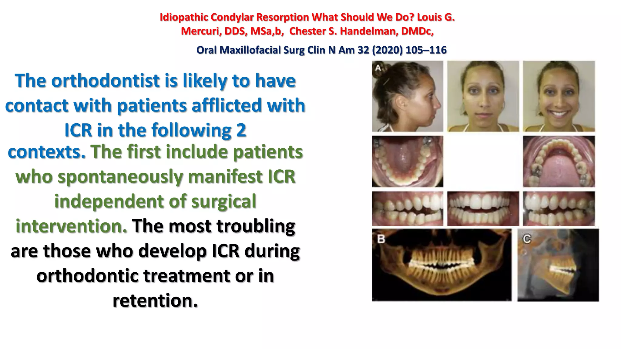Ortho manage of idiopathic condylar resorption part 1 | PPTX