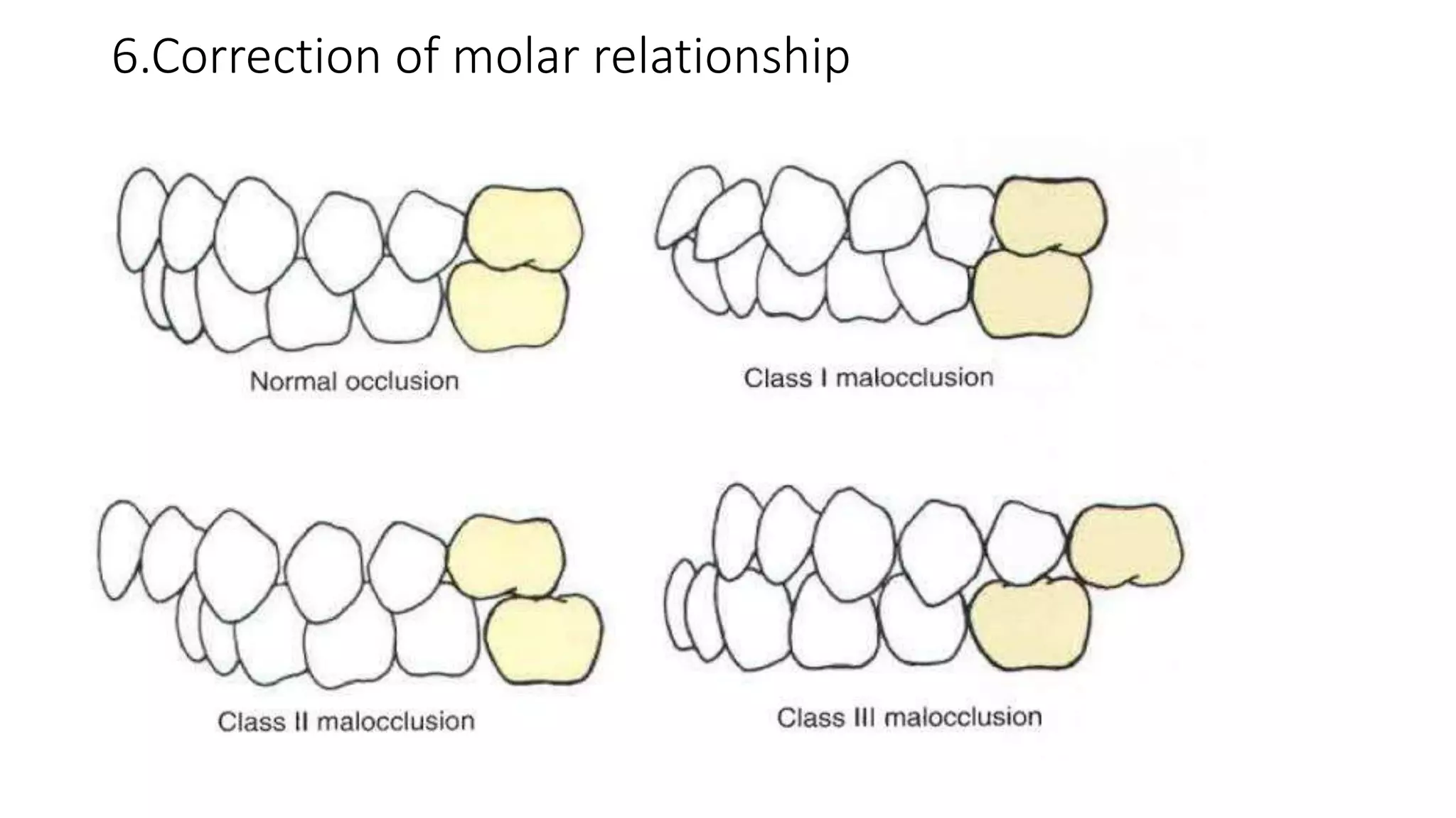 Orthodontic treatment planning | PPTX