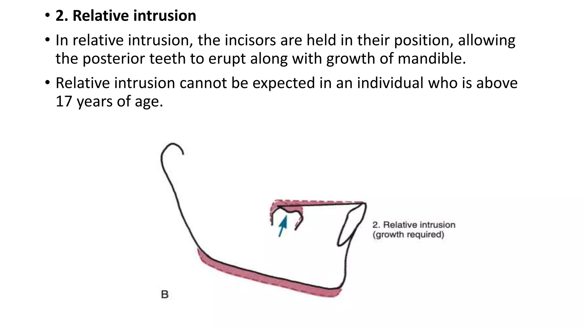 Orthodontic treatment planning | PPTX