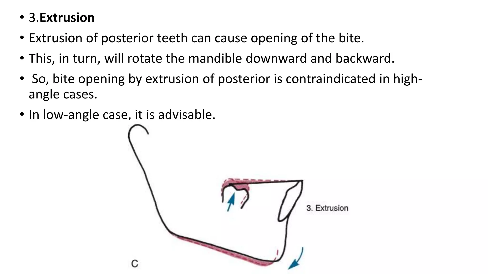 Orthodontic treatment planning | PPTX