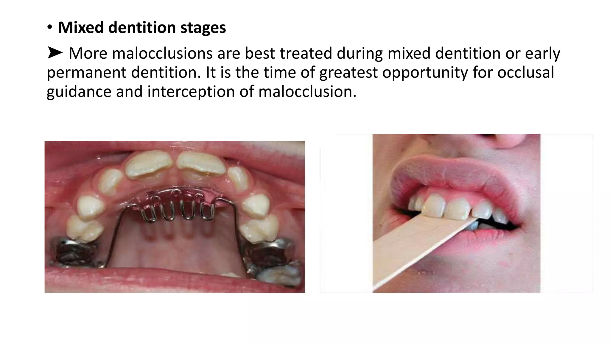 Orthodontic treatment planning | PPTX