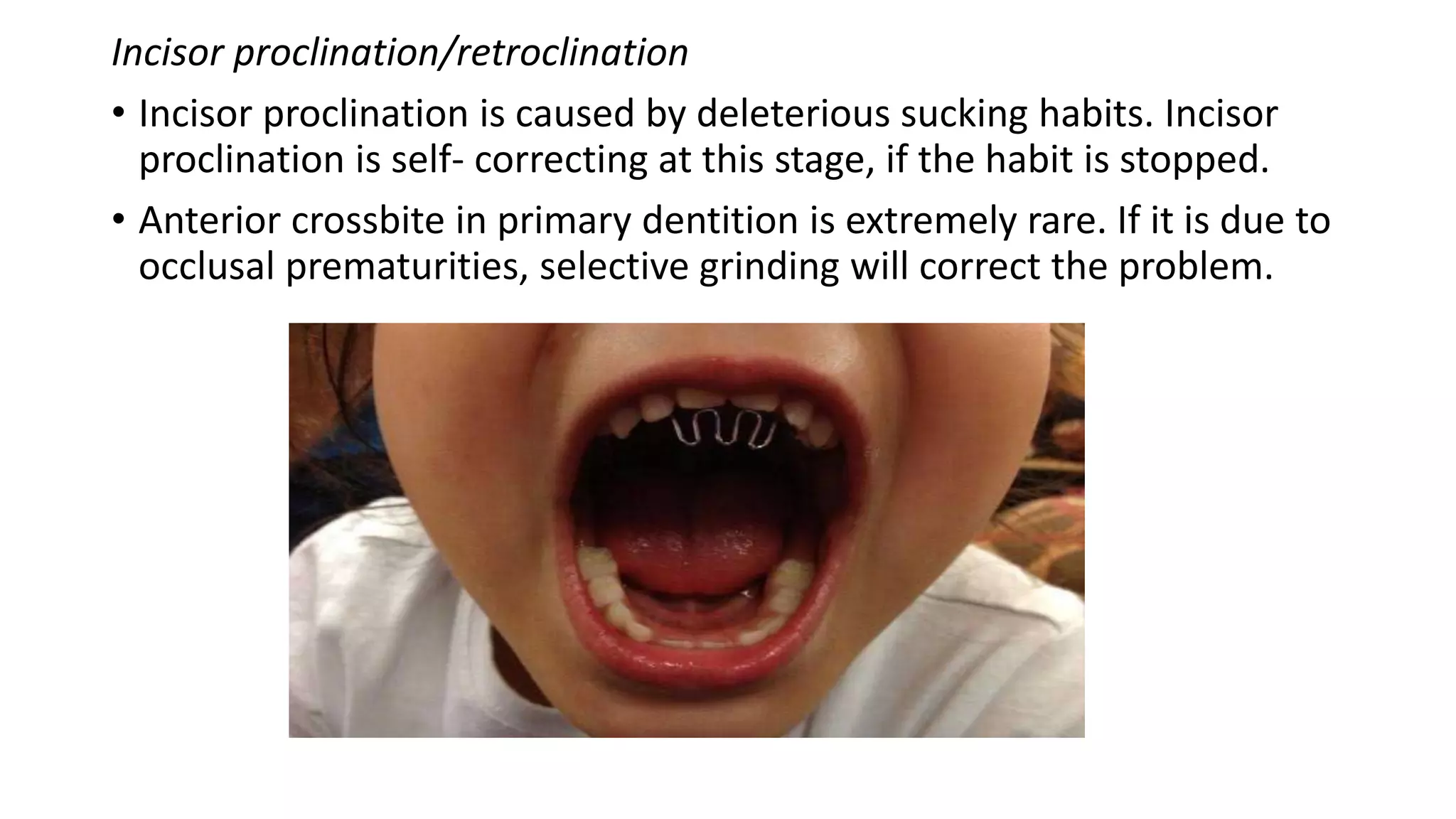 Orthodontic treatment planning | PPTX