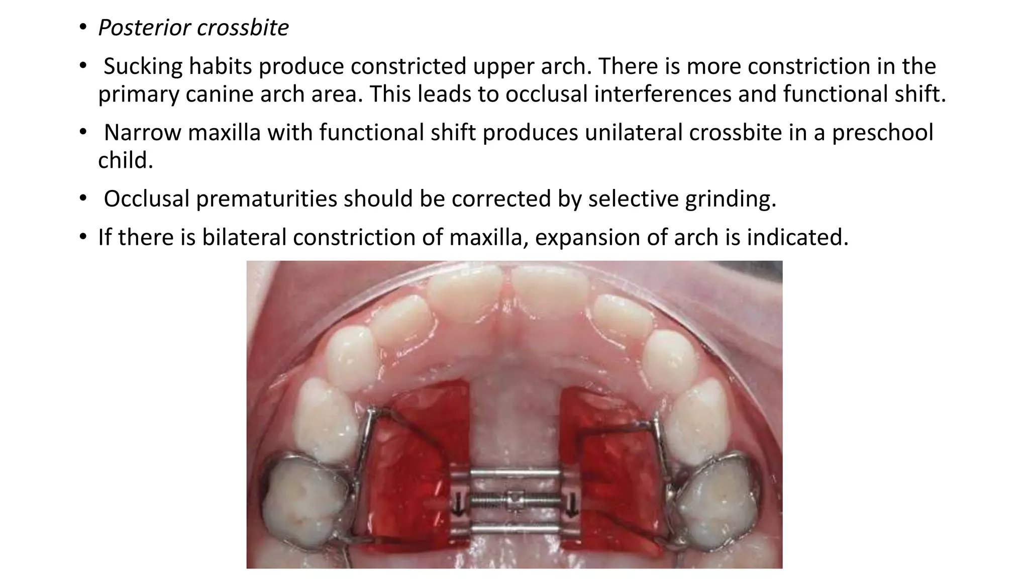 Orthodontic treatment planning | PPTX