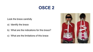 ORTHO OSCE for ortho entrance exams.pptx
