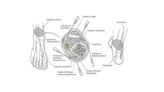 Orthopaedic analgesia and blocks | PPTX