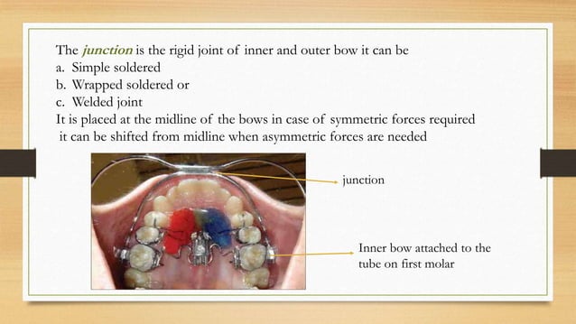 Orthopaedic appliance | PPTX | Dental Health | Diseases and Conditions