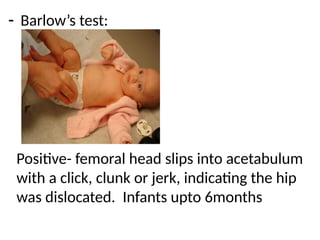 Orthopaedic assessment of_pediatric_conditions | PPT