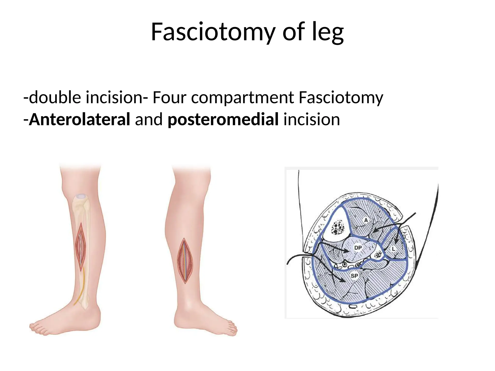 Common orthopaedic emergency clinical features and management | PPTX