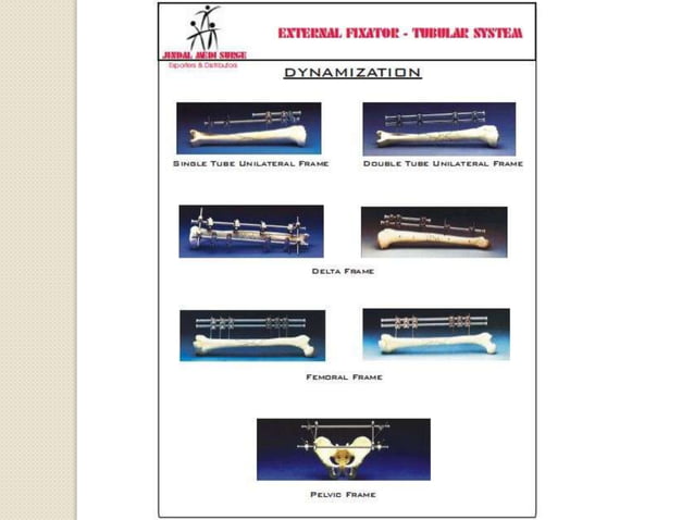 Orthopedic External Fixator | PPT