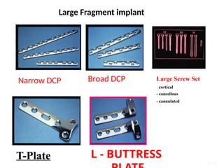 orthopaedic implant.pptx orthopaedic implant.pptx