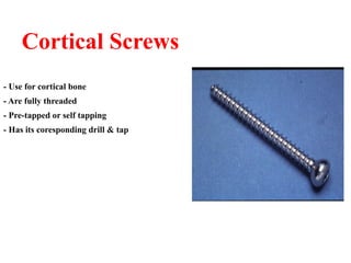 orthopaedic implant.pptx orthopaedic implant.pptx
