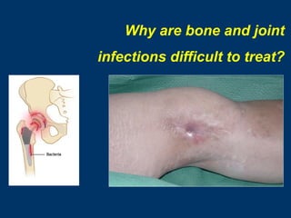 Orthopaedic infection management dr.saroj | PPT