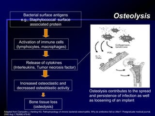Orthopaedic infection management dr.saroj | PPT