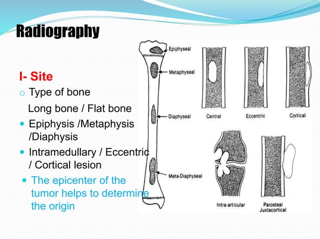 Orthopaedic oncology | PPTX