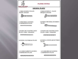 Orthopaedic Plating Implants | PPT