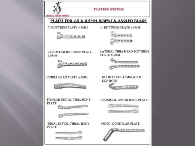 Orthopaedic Plating Implants | PPT