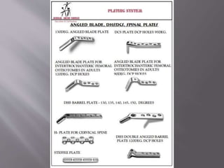 Orthopaedic Plating Implants | PPT