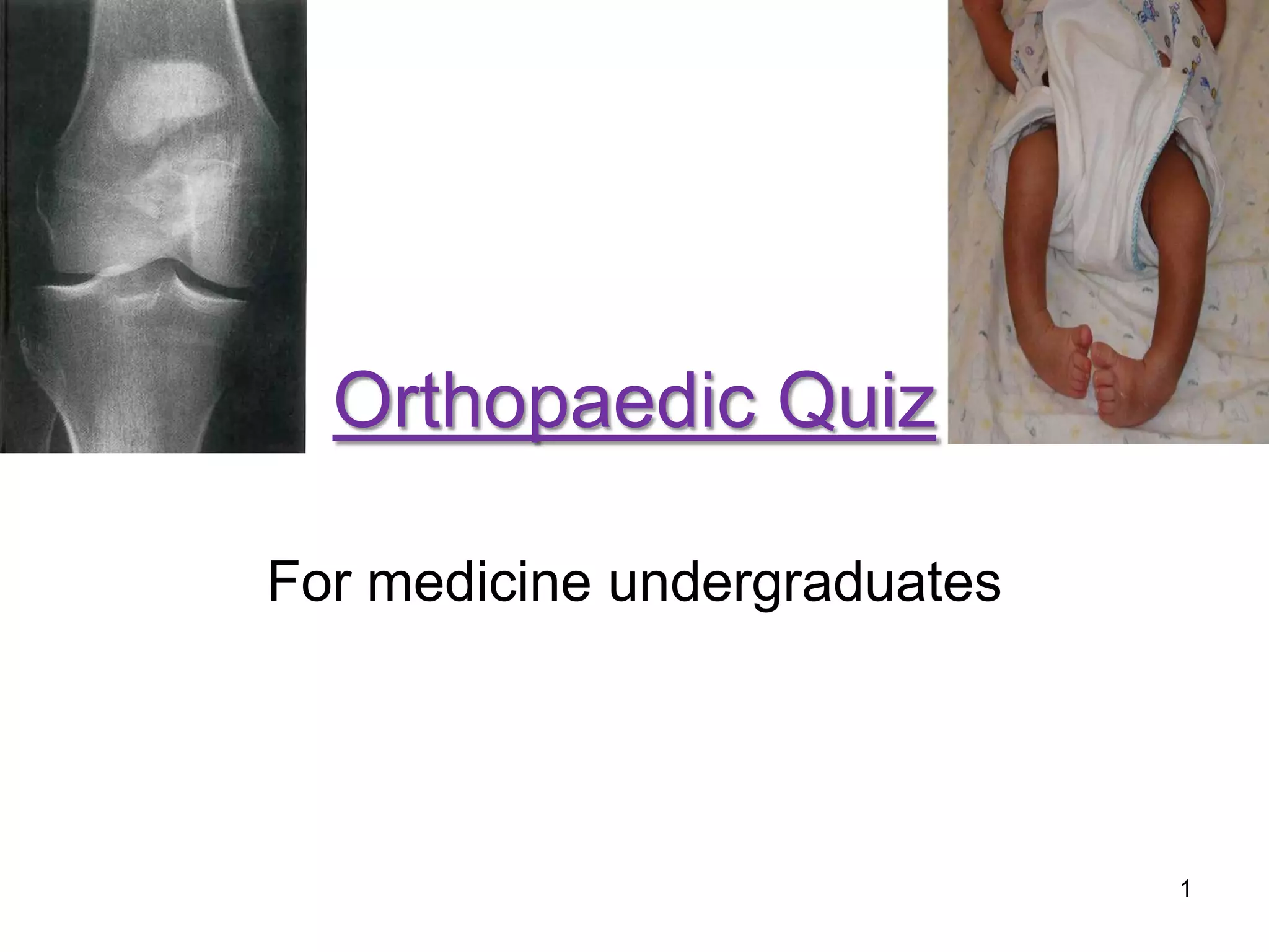 Orthopaedic quiz.by.yapa wijeratne | PPSX | Death, Injury, or Military ...