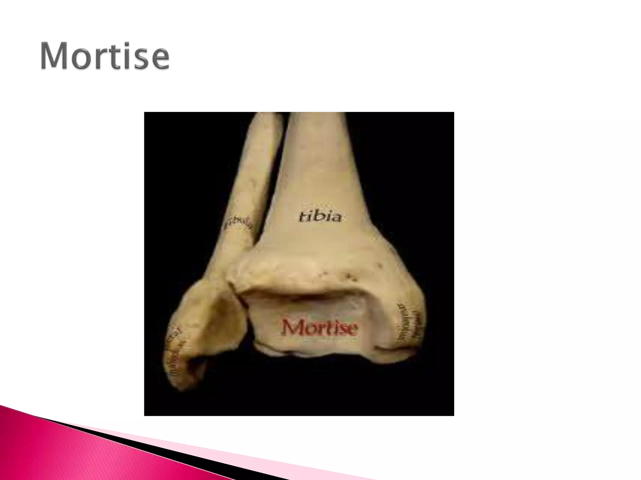 Tibia and fibula diaphysis, ankle and foot injuries | PPTX