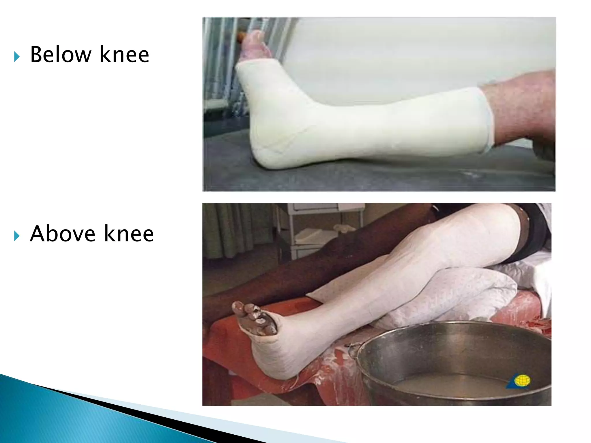 Orthopaedics | PPT