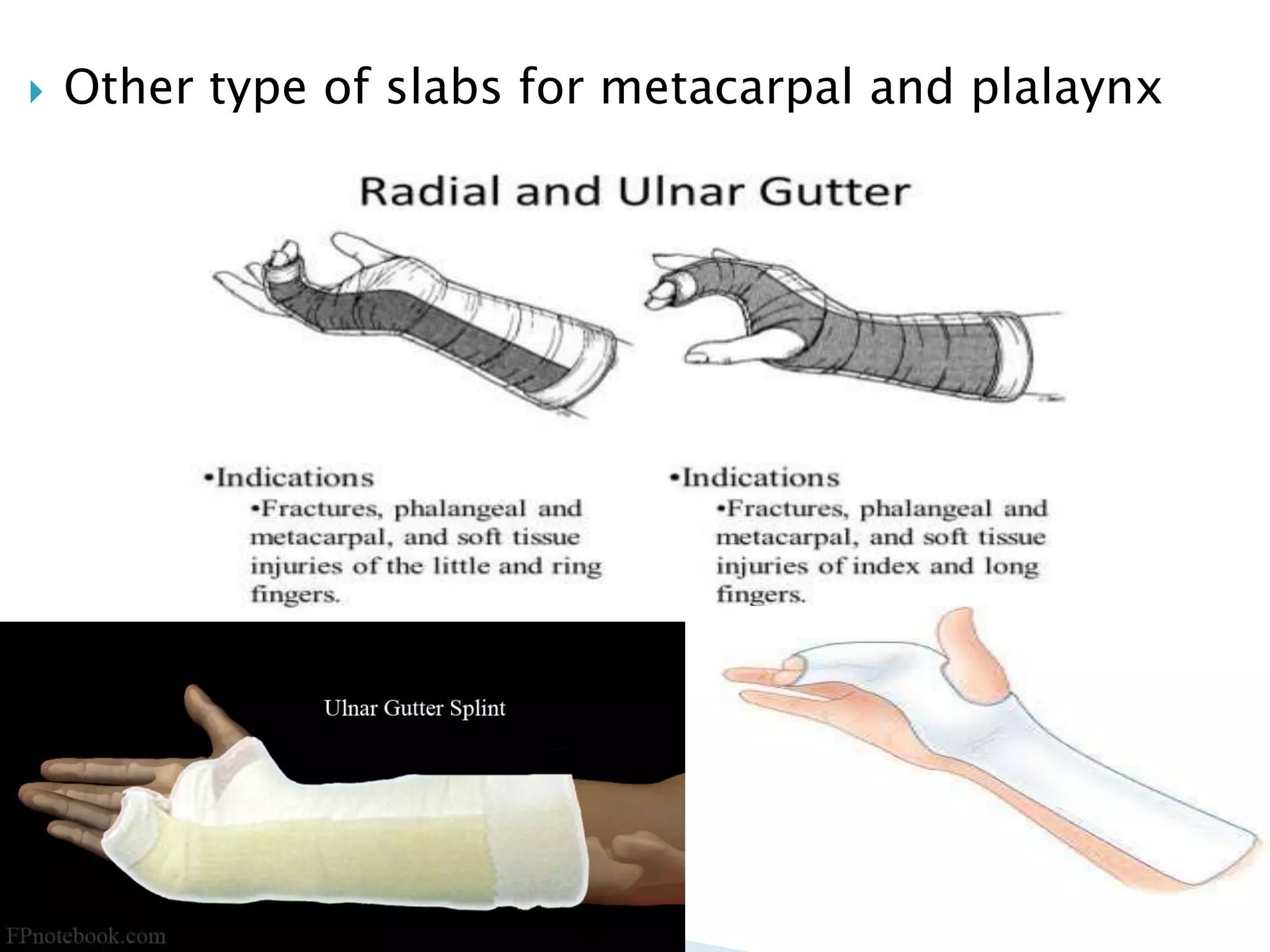 Orthopaedics | PPT
