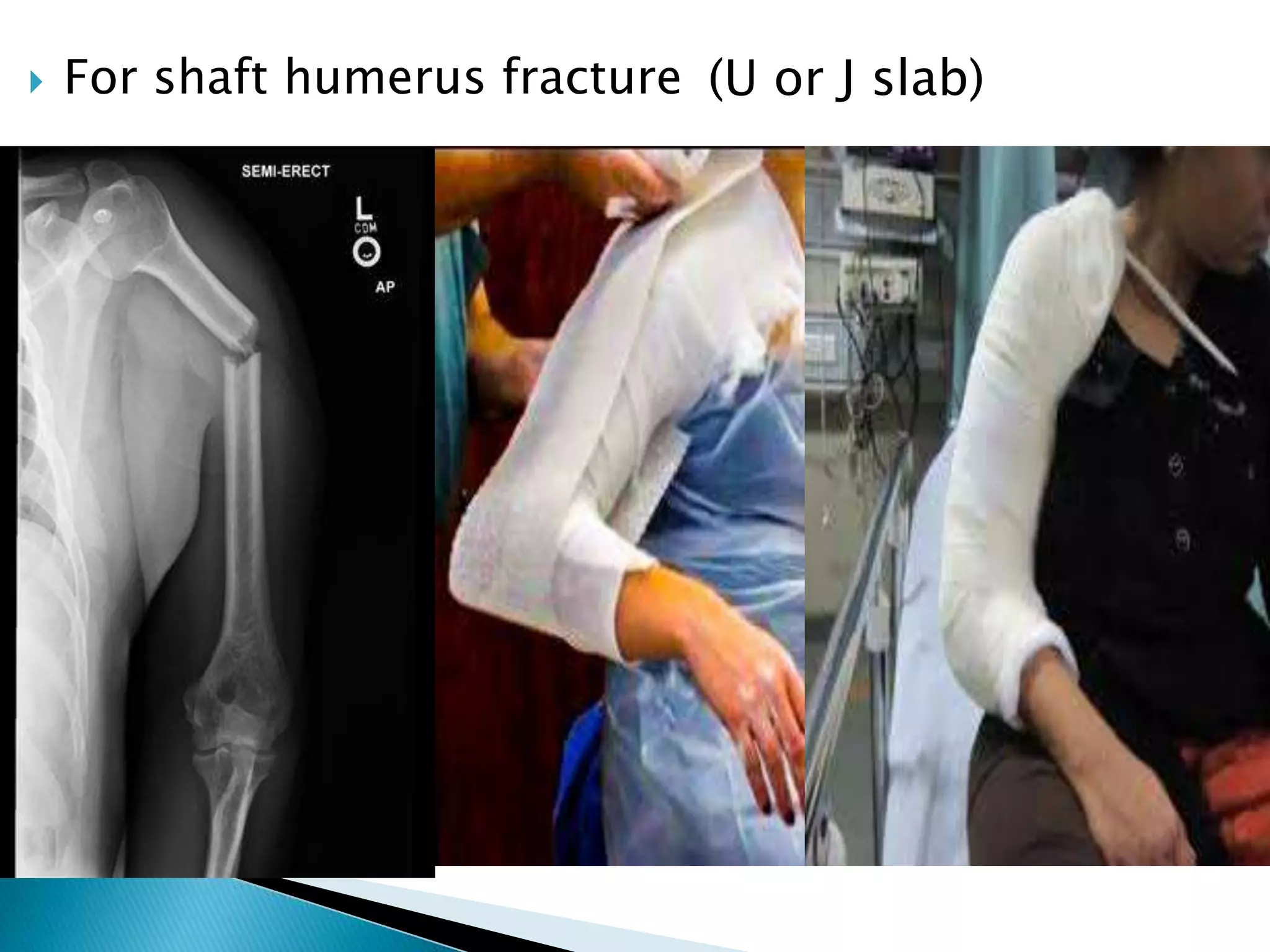 Orthopaedics | PPT