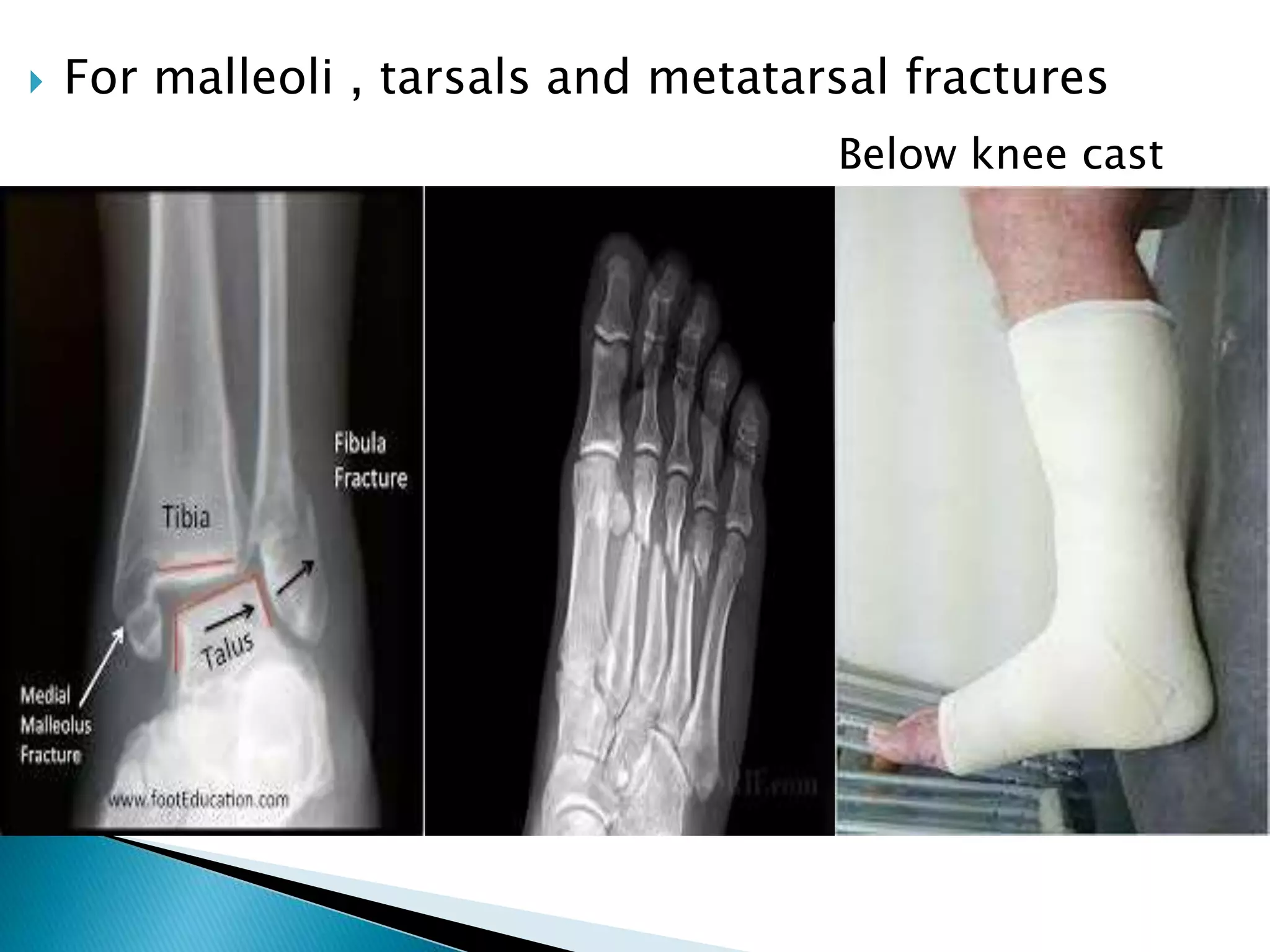 Orthopaedics | PPT