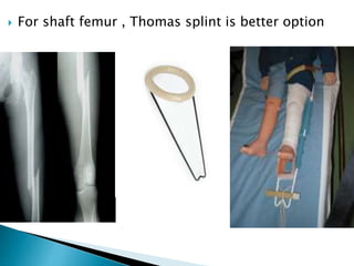 Orthopaedics | PPT