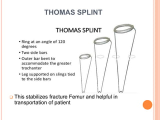Orthopaedics history | PPTX