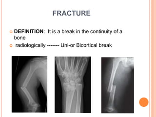 Orthopaedics history | PPTX