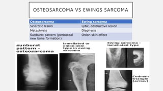 Orthopaedics and pathology integrated– pathology.pptx | Bone and Joint Conditions | Diseases and ...