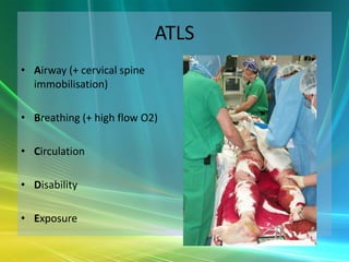Orthopaedic Trauma - The Basics | PPTX