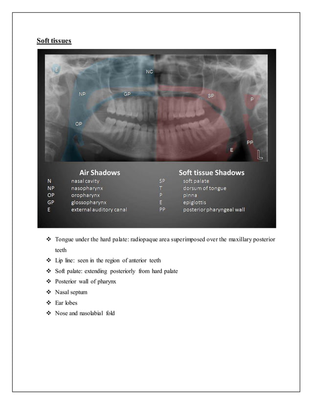 Orthopantomogram | DOCX | Dental Health | Diseases and Conditions