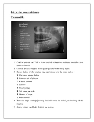 Orthopantomogram | DOCX