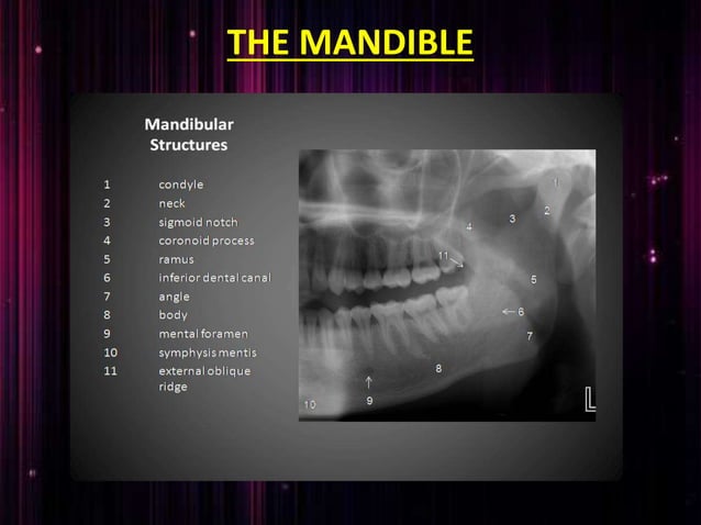 Orthopantomogram.ppt | Dental Health | Diseases and Conditions