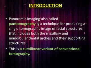 Orthopantomogram.ppt