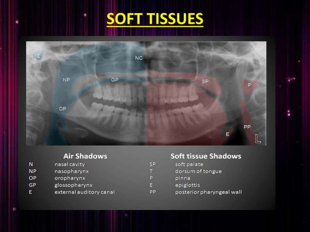 Orthopantomogram.ppt | Dental Health | Diseases and Conditions