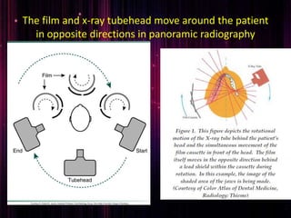 Orthopantomogram.ppt
