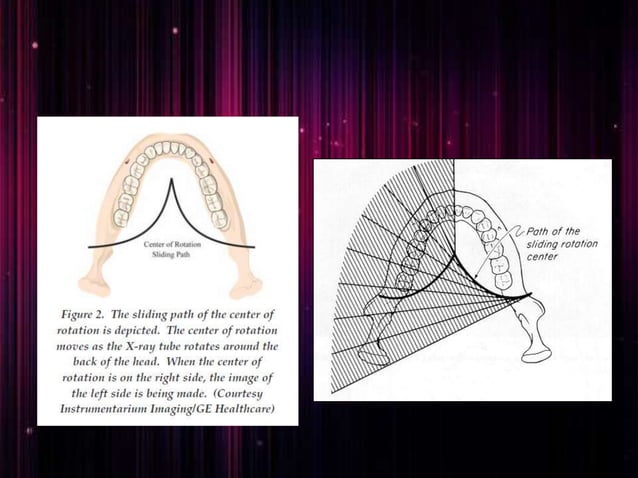 Orthopantomogram.ppt | Dental Health | Diseases and Conditions