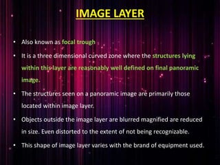 Orthopantomogram.ppt