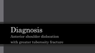Ant.shoulder dislocation | PPTX