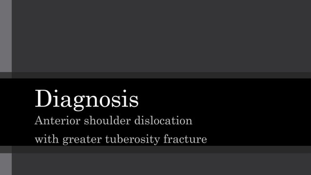 Ant.shoulder dislocation | PPT
